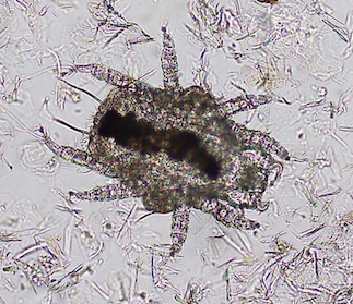 Clinical Image: What Species Is This Mite?